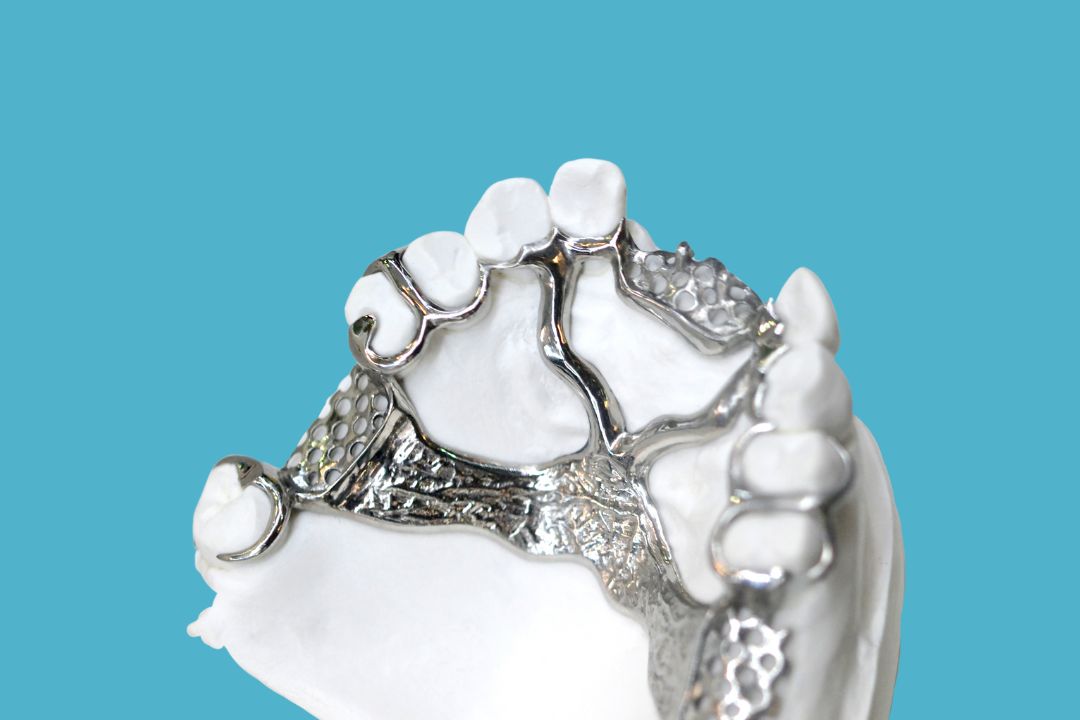Quality Custom Dental Restorations | Reliance Dental Lab